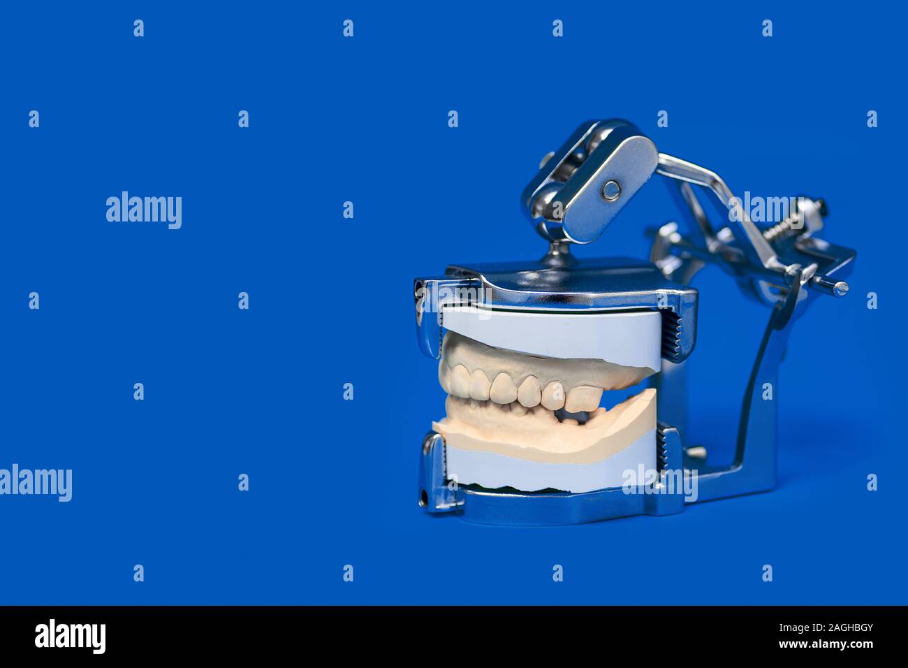 jaw cast in a special medical device on a blue background Stock Photo ...