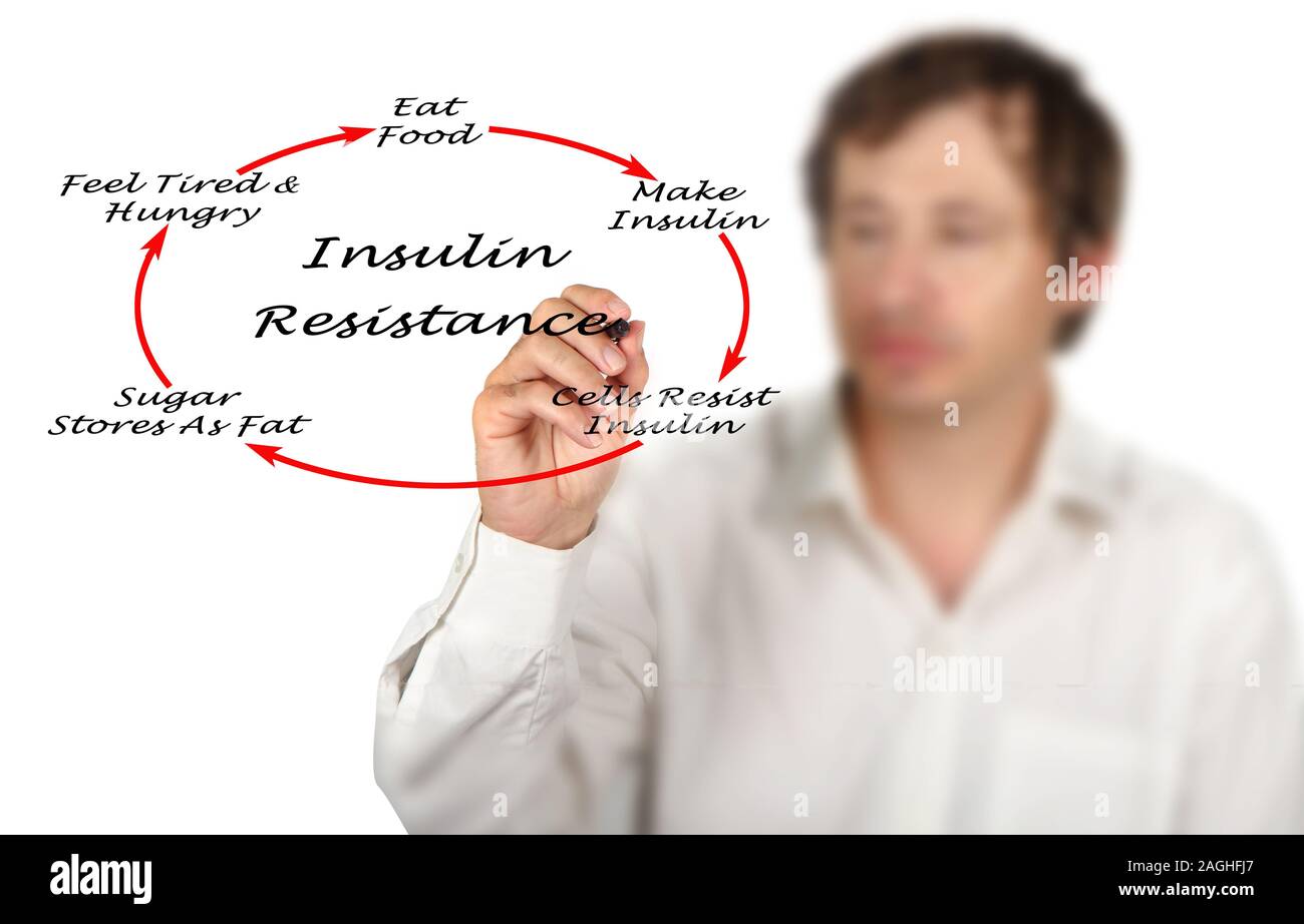 Development of Insulin Resistance Stock Photo - Alamy