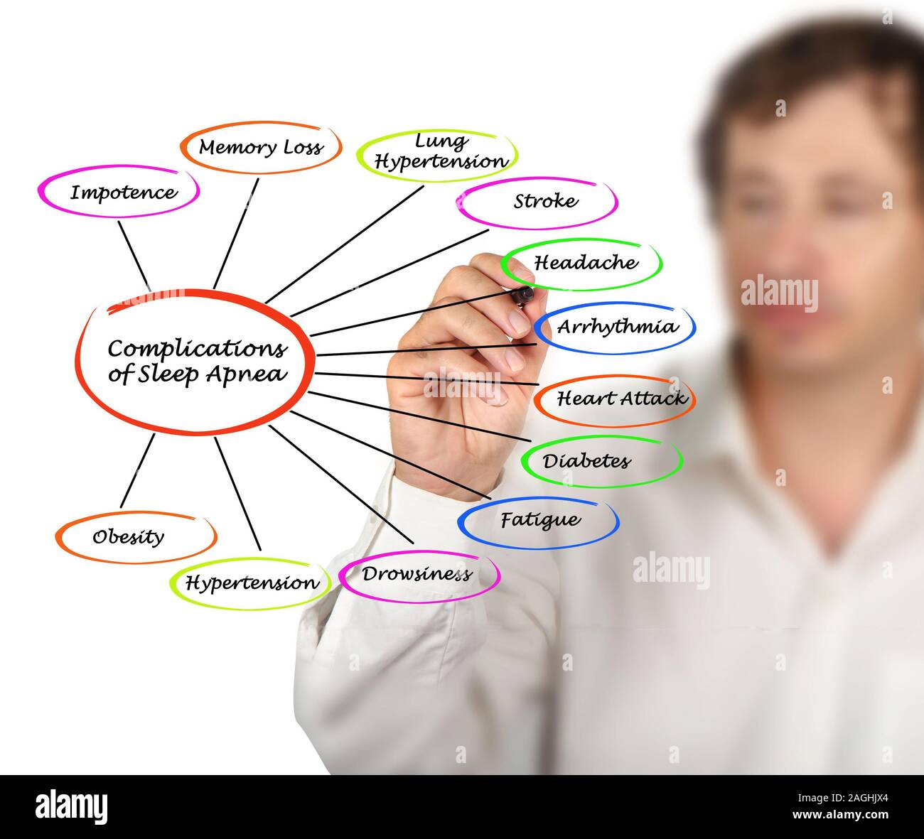 Complications of Sleep Apnea Stock Photo - Alamy