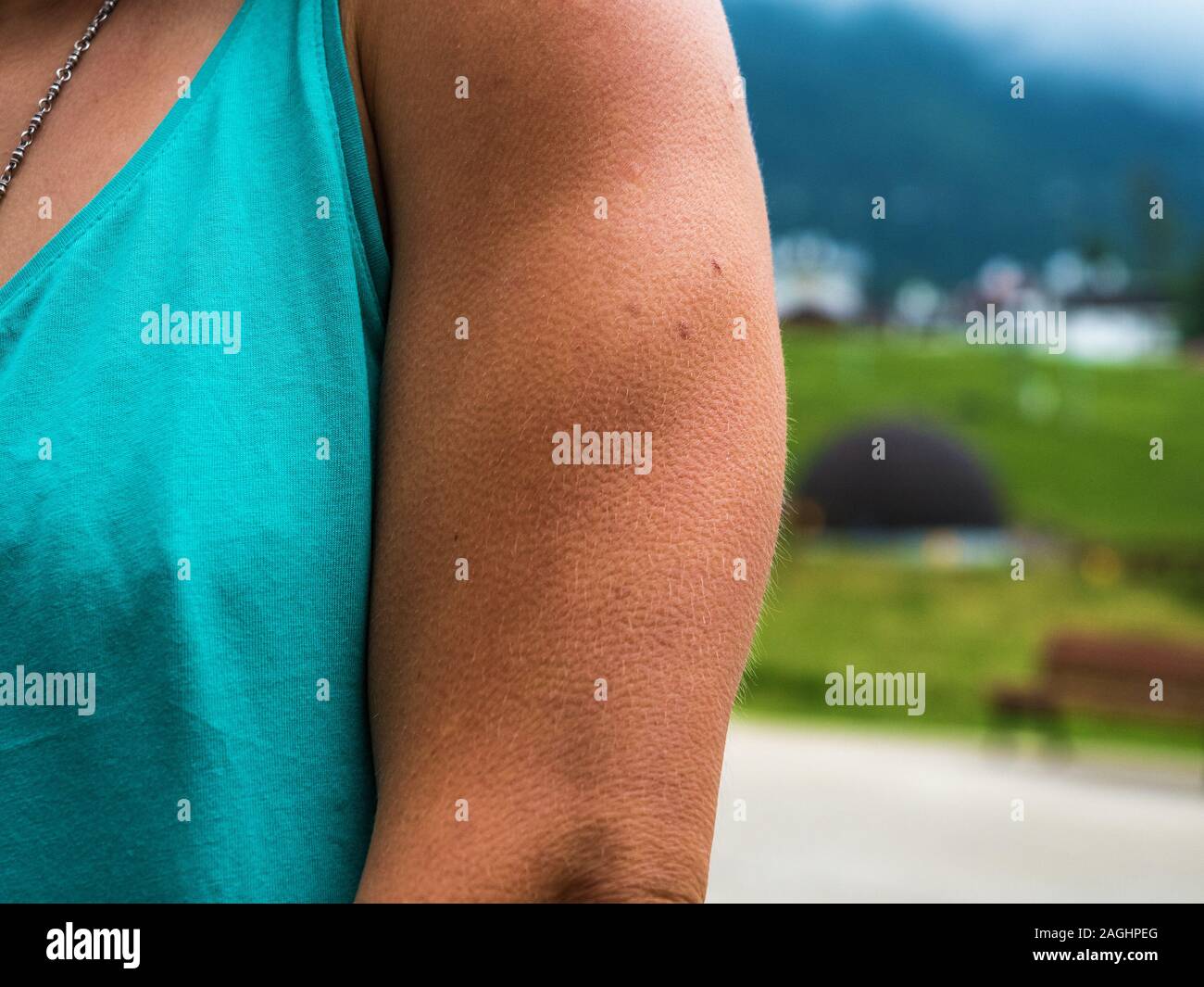 Goose bumps girl hi-res stock photography and images - Alamy