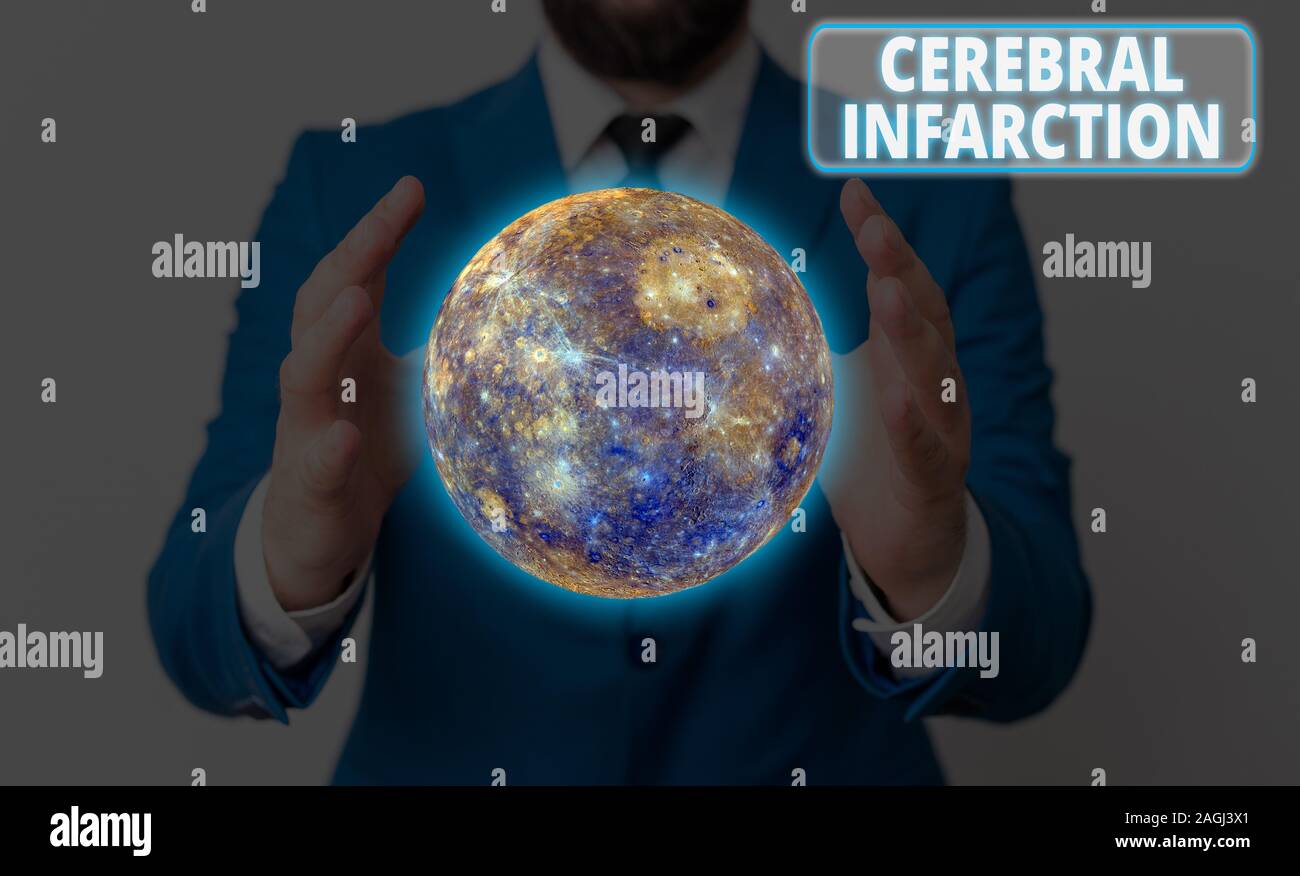 Conceptual hand writing showing Cerebral Infarction. Concept meaning ...