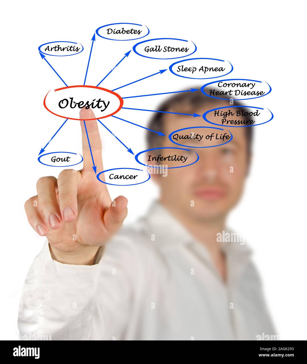 Diagram of Obesity Stock Photo - Alamy