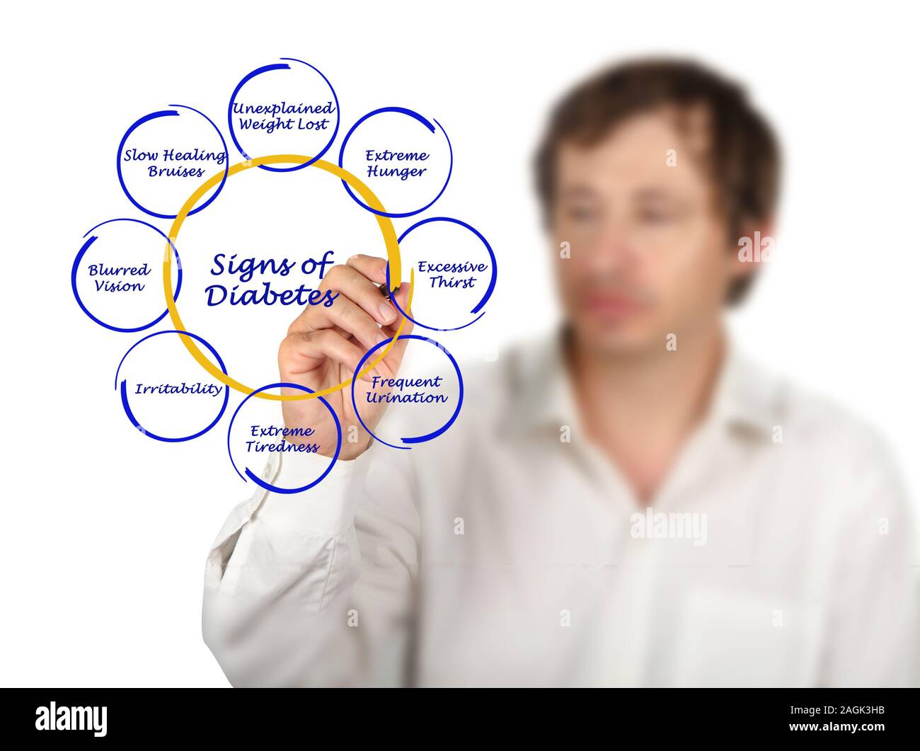 Sign of diabetes Stock Photo - Alamy
