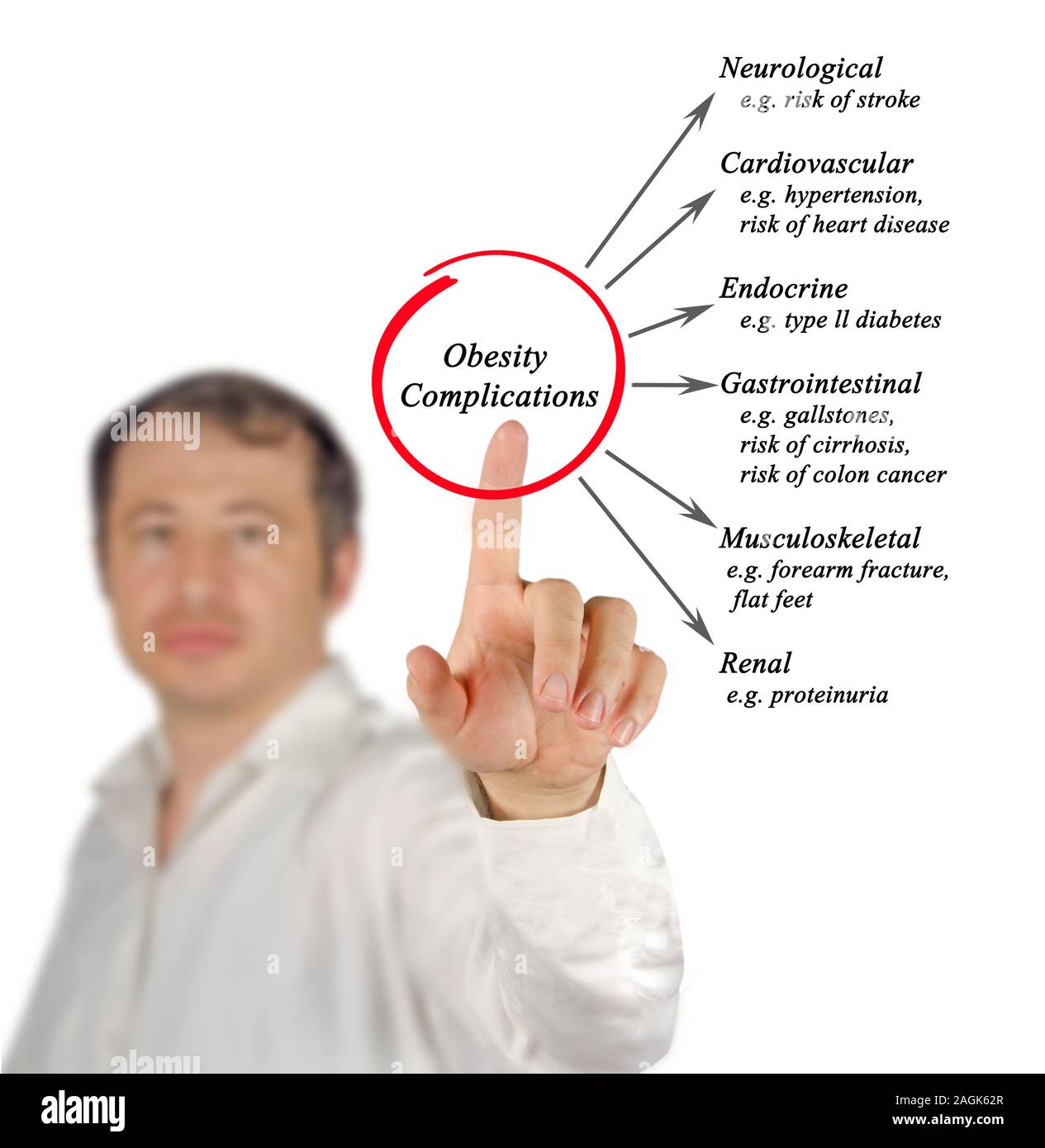 Complications of obesity Stock Photo - Alamy