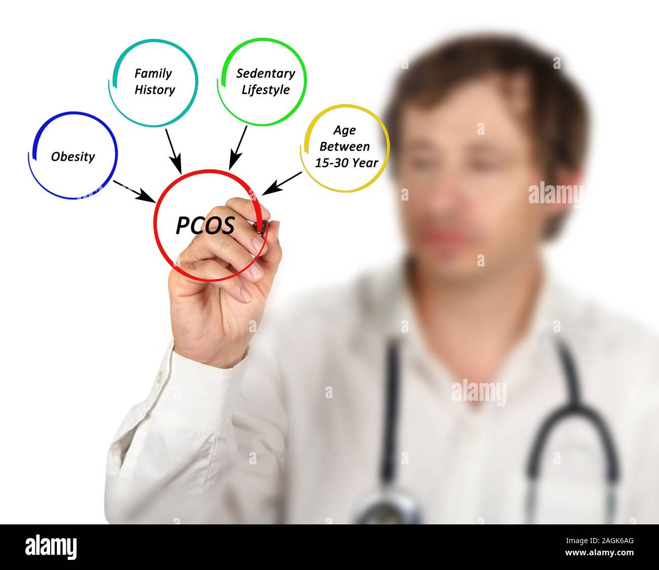 Man presenting Causes of Polycystic Ovarian Syndrome Stock Photo - Alamy