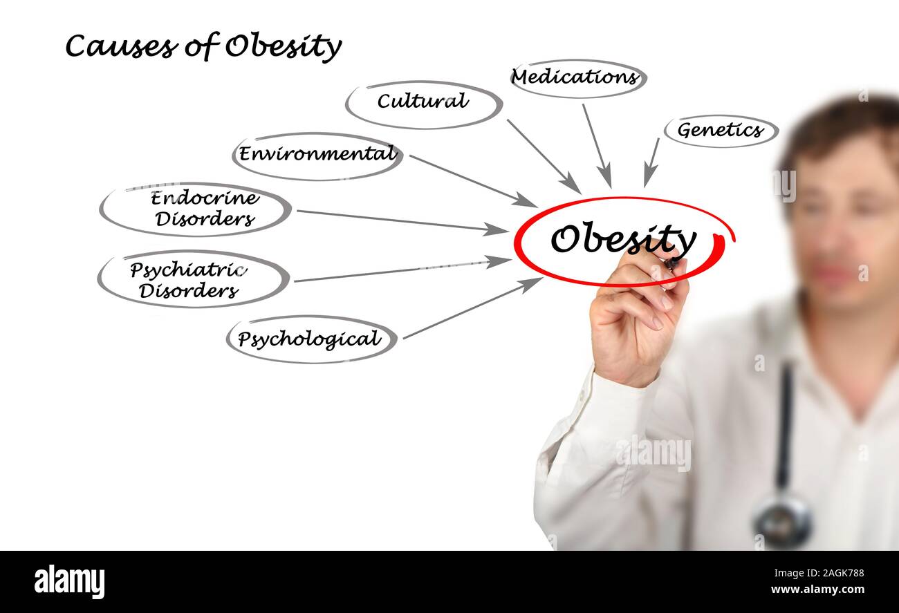 Causes of Obesity Stock Photo - Alamy