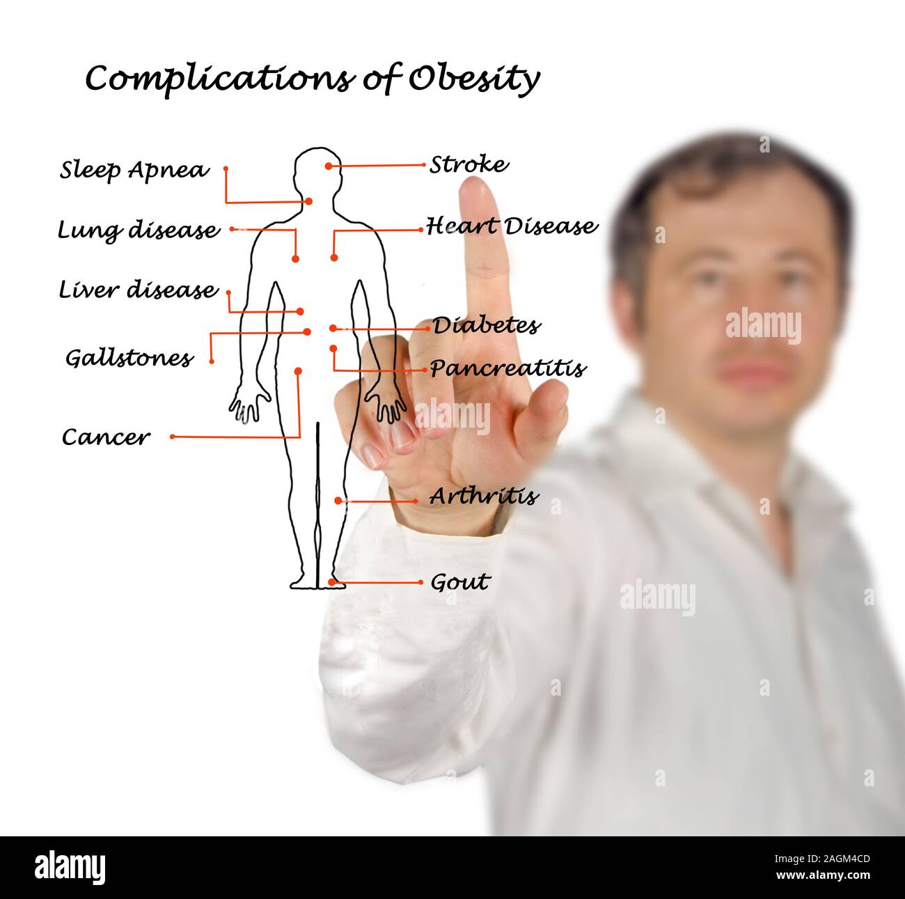 Complications of Obesity Stock Photo - Alamy