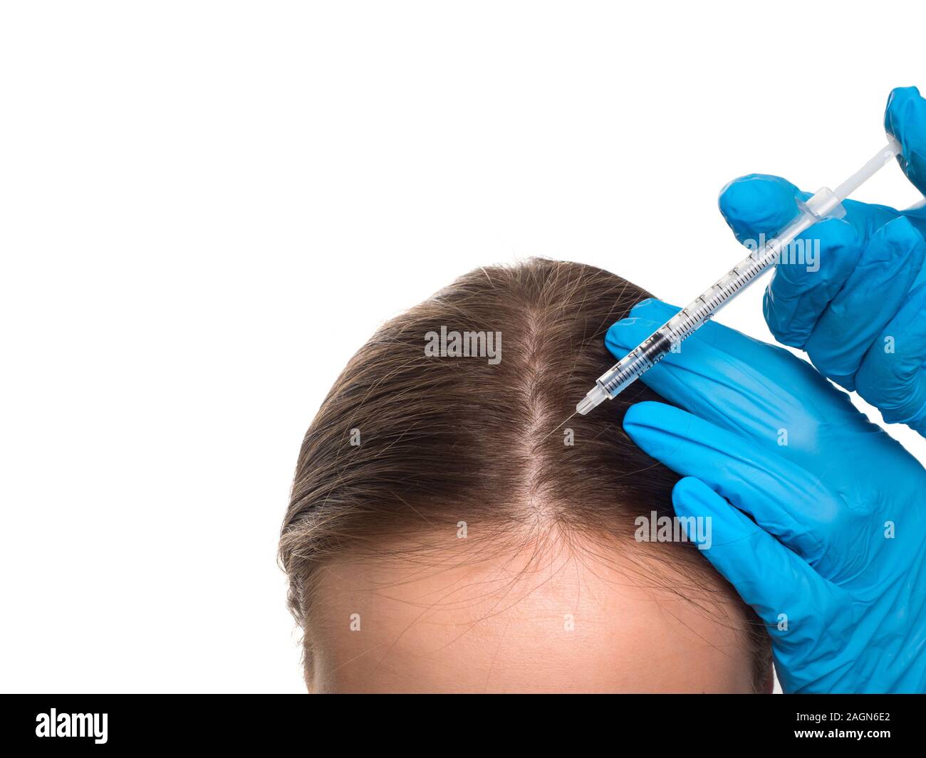 Woman with hair loss problem receiving injection, closeup view ...