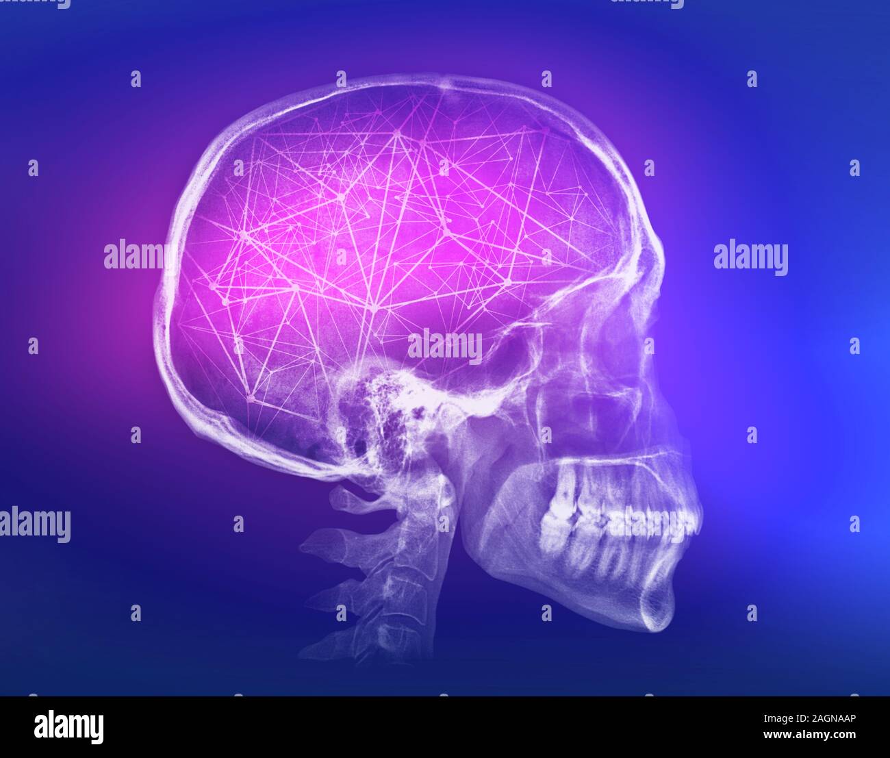Human skull X-ray image. Artificial intelligence futuristic concept ...