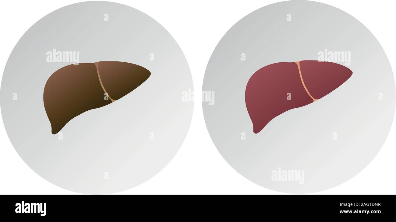 Human sick liver icon. Medical concept. Vector illustration Stock ...