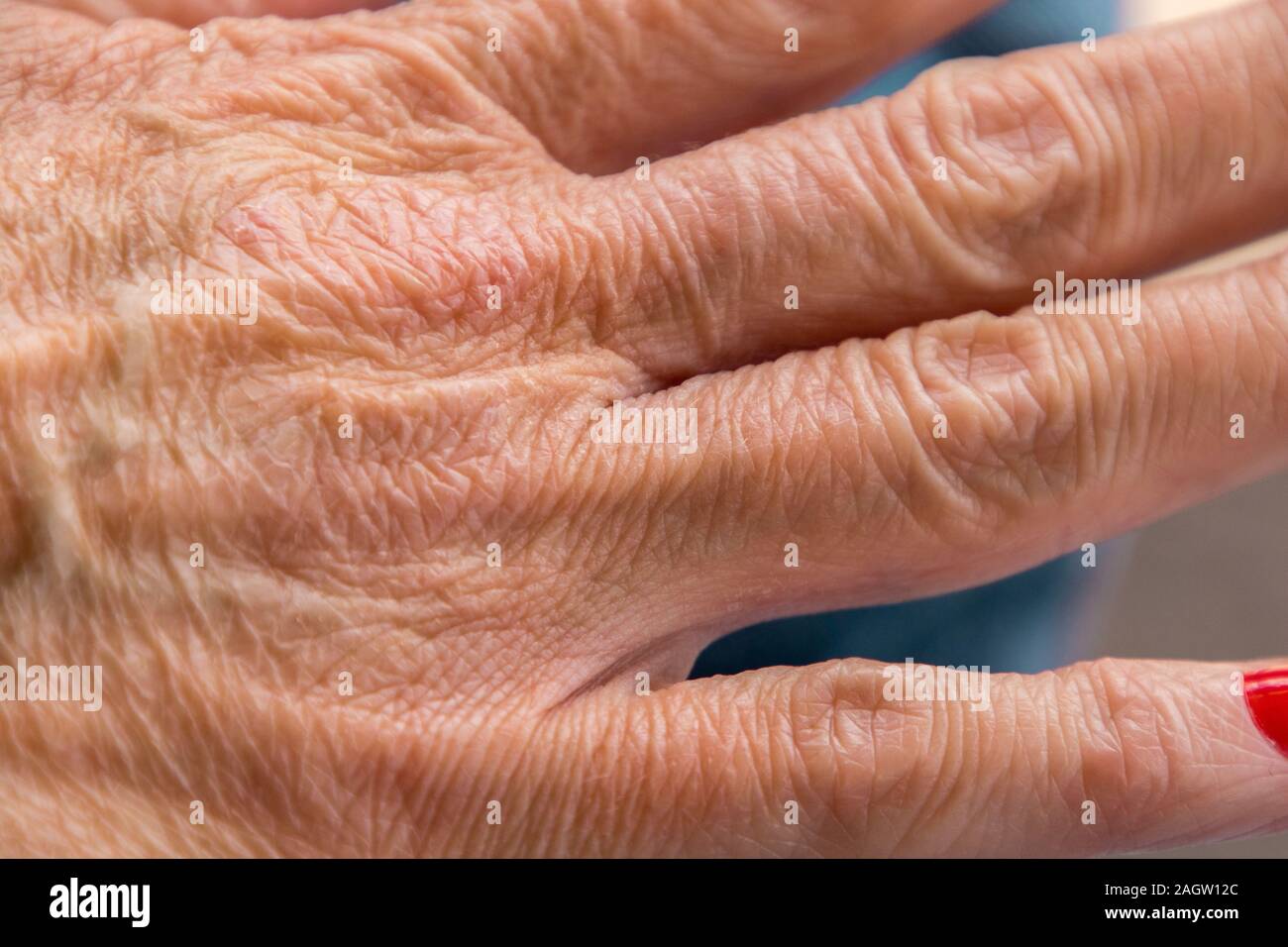 White Knuckles Stock Photos & White Knuckles Stock Images - Alamy