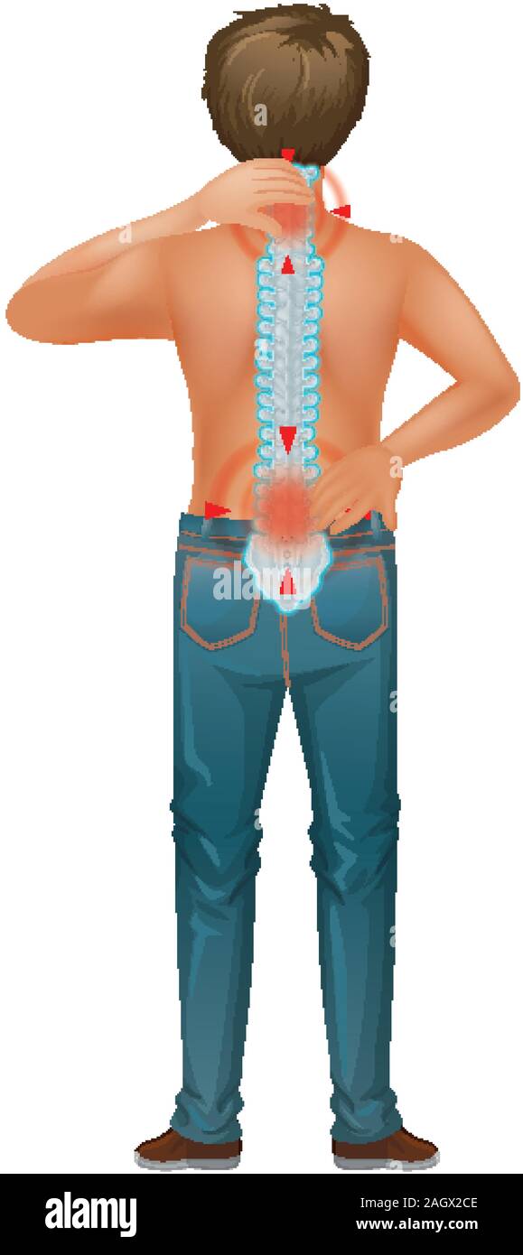 Back of man and his back pain illustration Stock Vector Image & Art - Alamy
