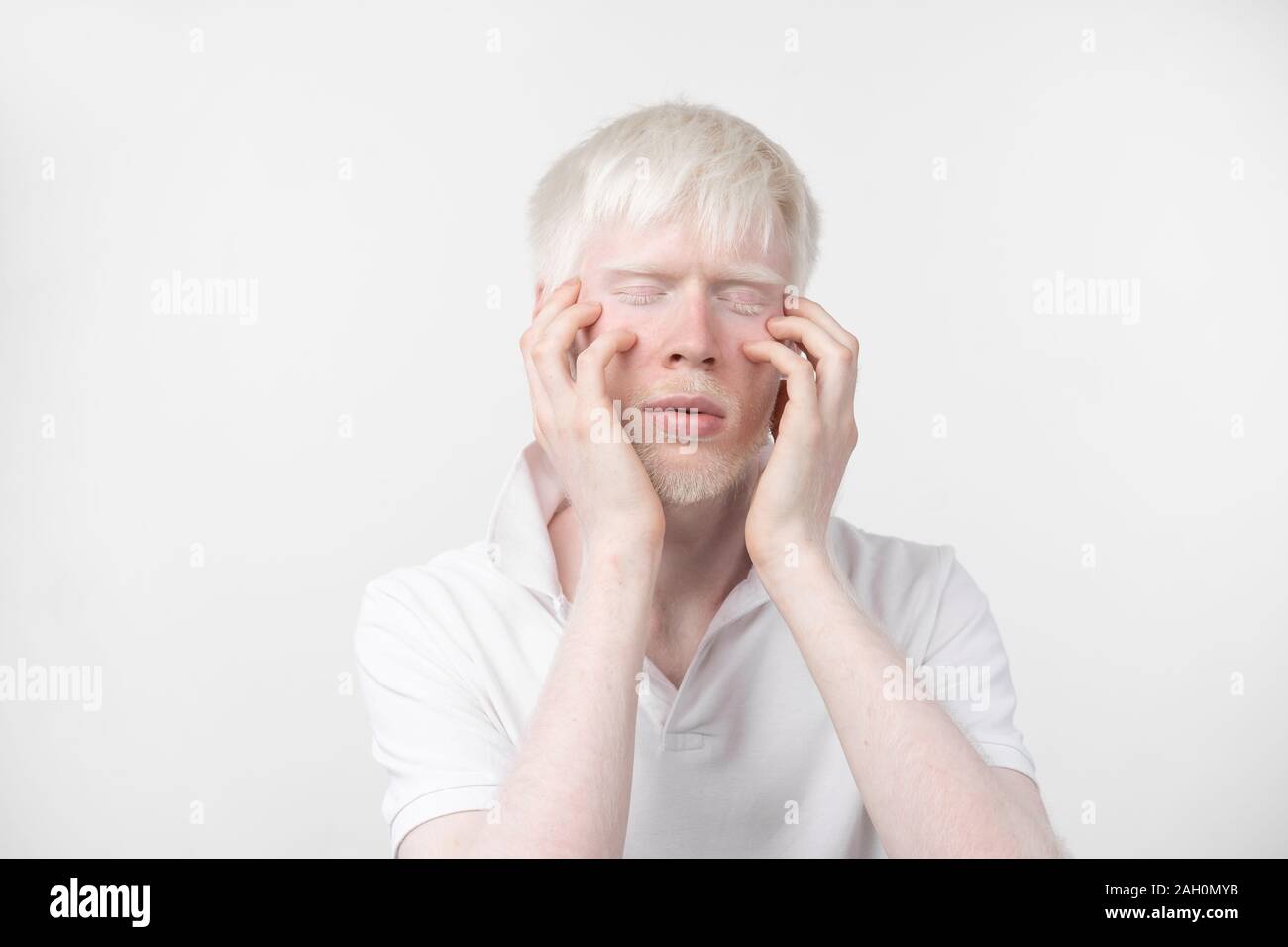portrait of an albino man in studio dressed t-shirt isolated on a white ...