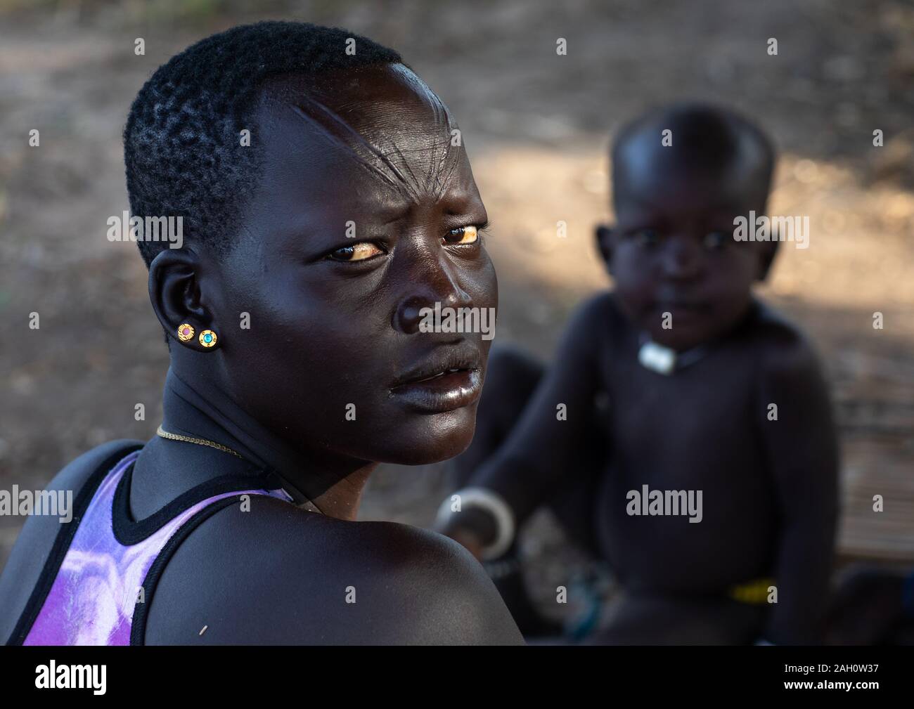 Forehead scar hi-res stock photography and images - Alamy