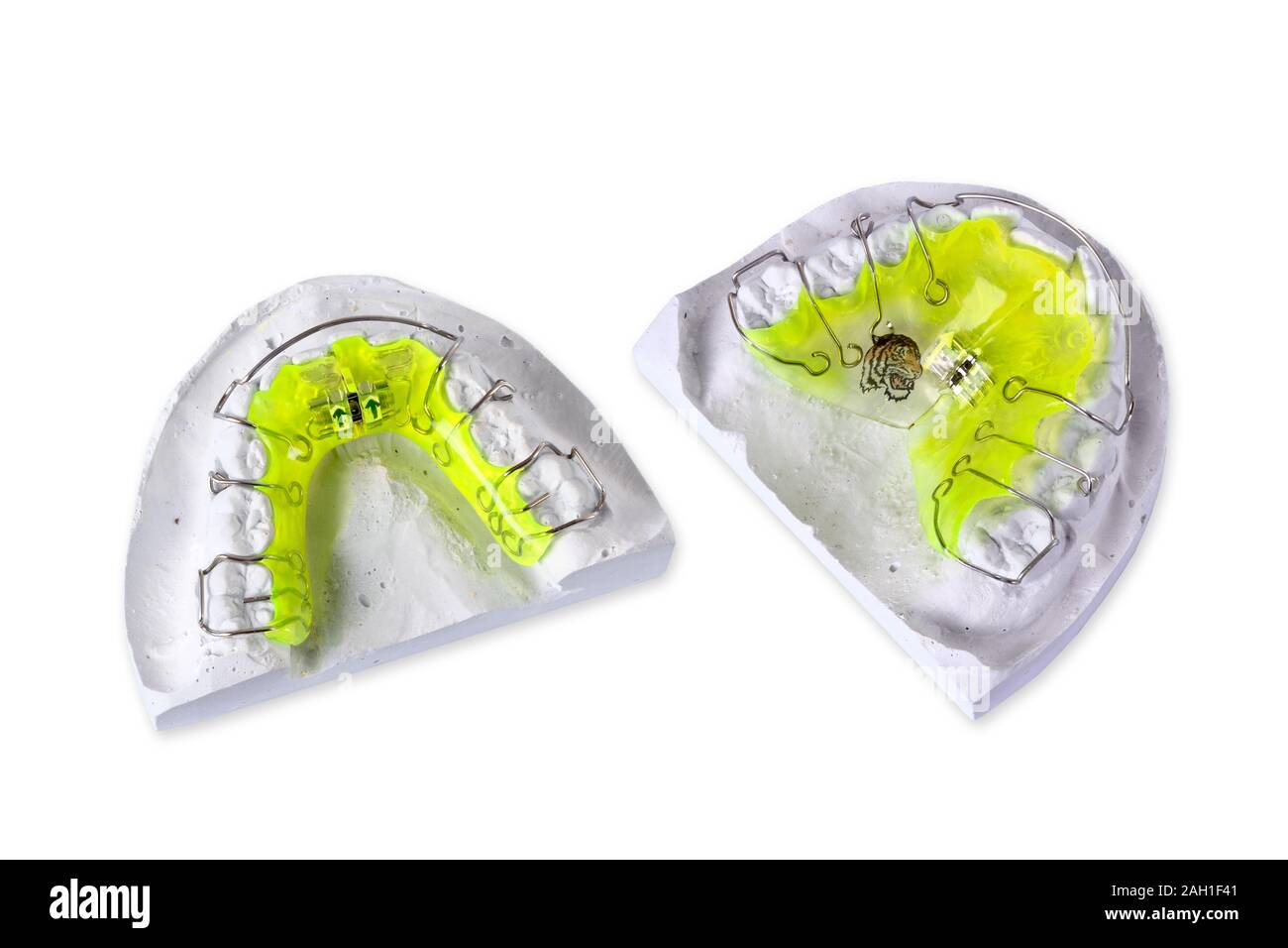Retainer with plaster cast Stock Photo - Alamy