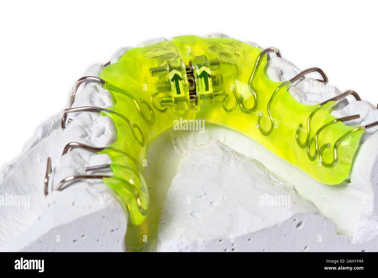 Retainer with plaster cast Stock Photo - Alamy