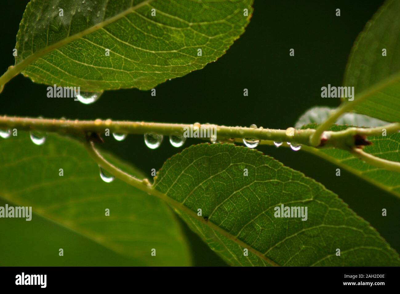 Vascular conditions hi-res stock photography and images - Alamy