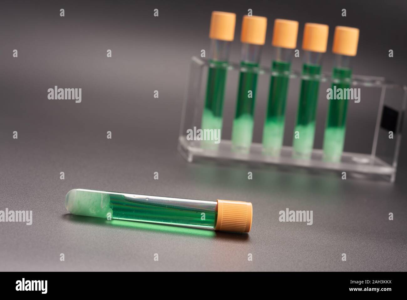 Test tubes with chemical samples in science laboratory Stock Photo - Alamy