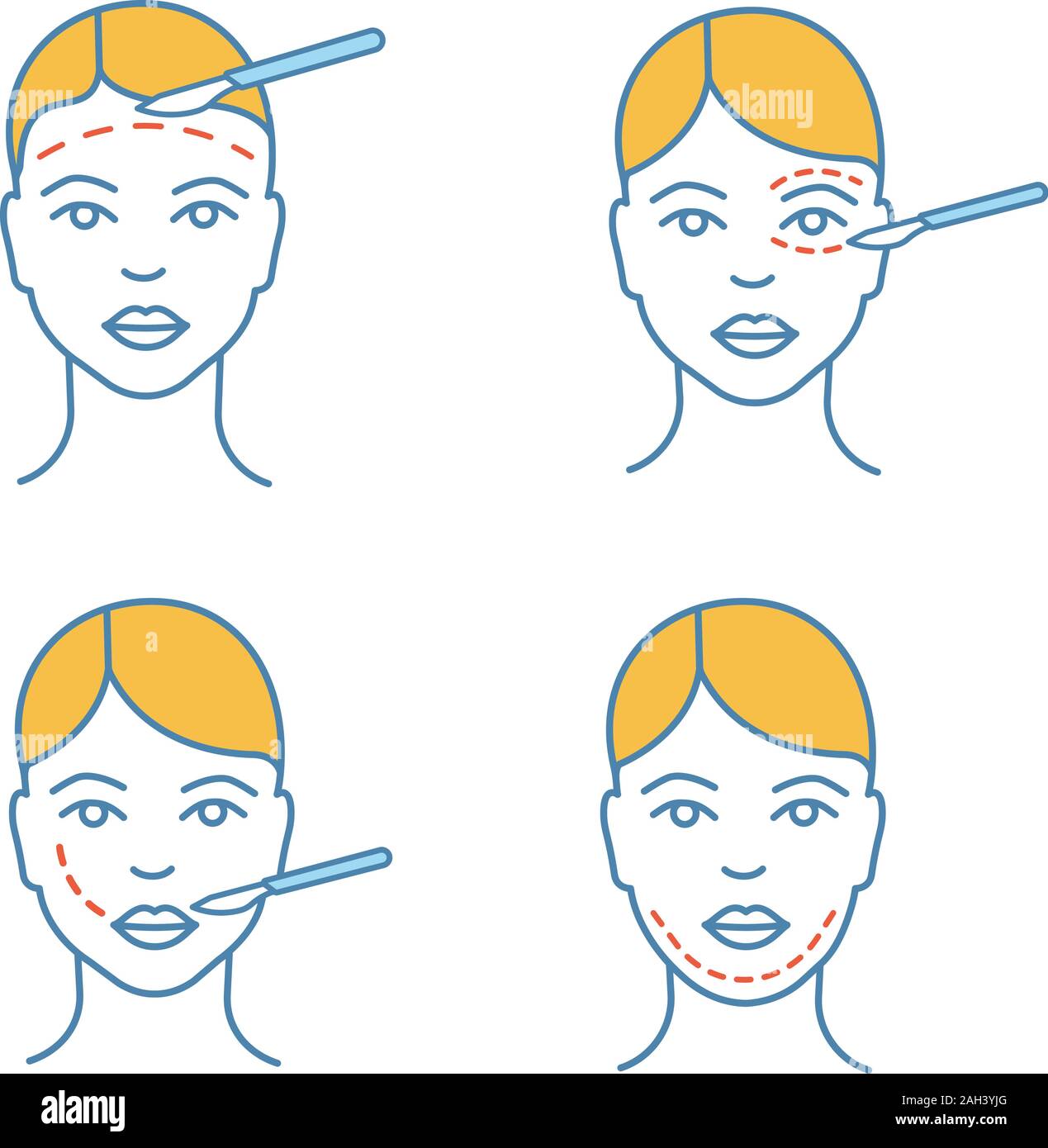 Plastic surgery color icons set. Facelift surgery, blepharoplasty ...