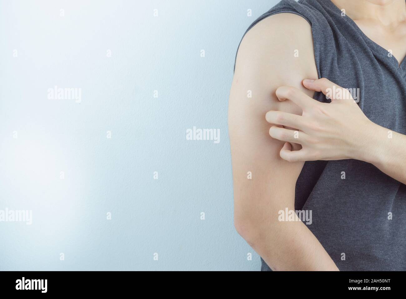 Close up man scratching his itchy arm with allergy rash by hand on ...