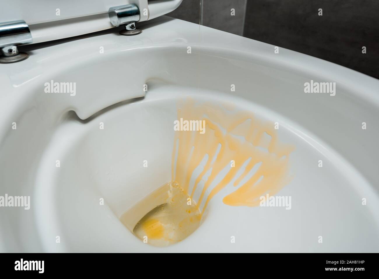 close up view of yellow liquid detergent in ceramic clean toilet bowl ...
