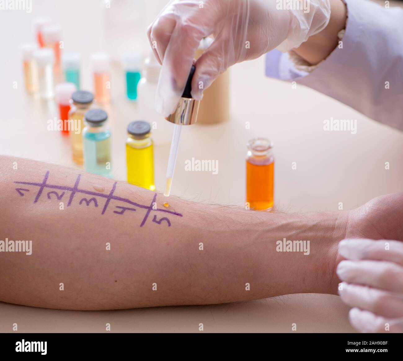 The doctor testing allergy reaction of patient in hospital Stock Photo ...