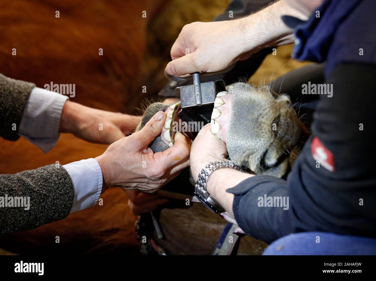 Y incision hi-res stock photography and images - Alamy