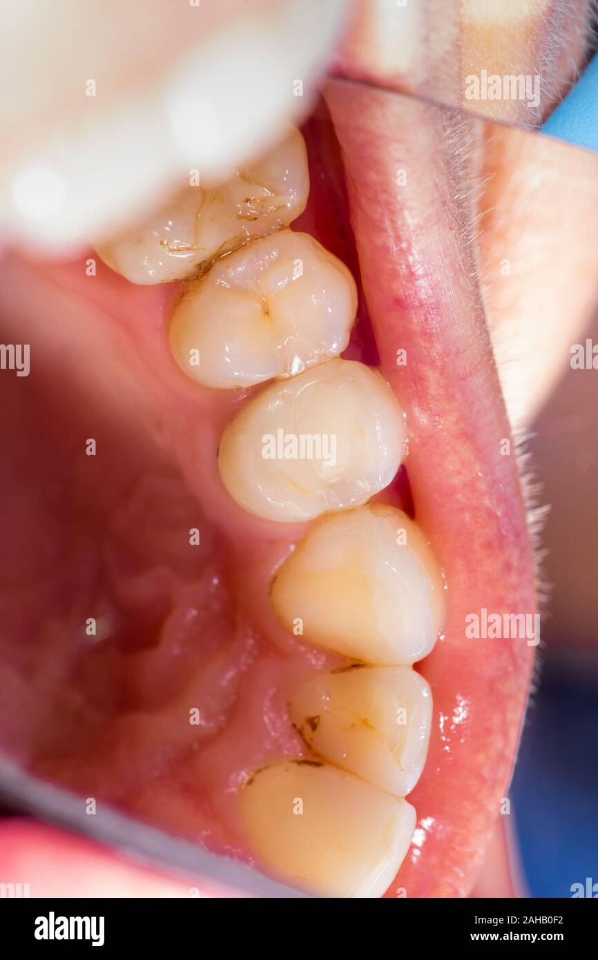 Chewing tool hi-res stock photography and images - Alamy
