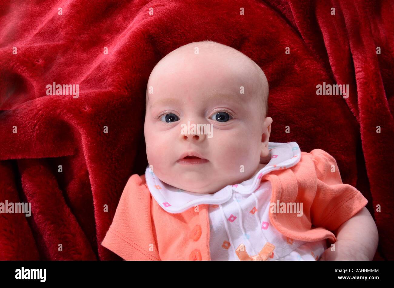 Syndrome infant hi-res stock photography and images - Alamy