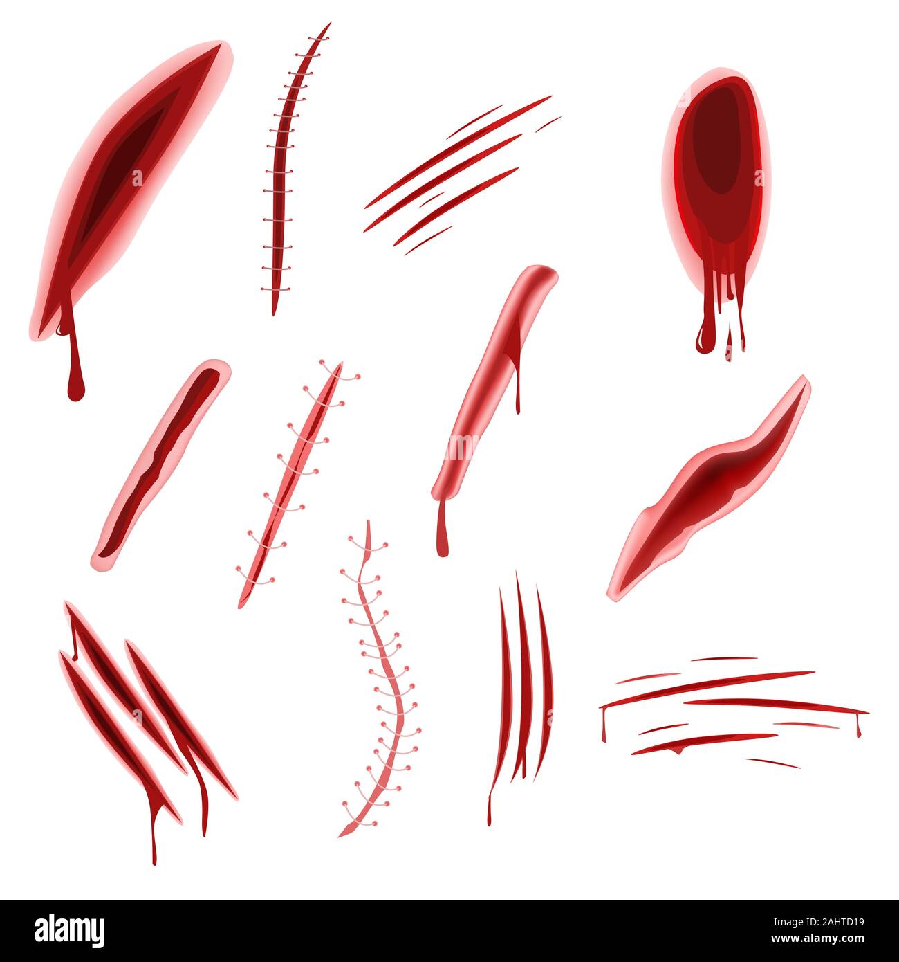 Graphic realistic wound set with blood splash isolated on white ...