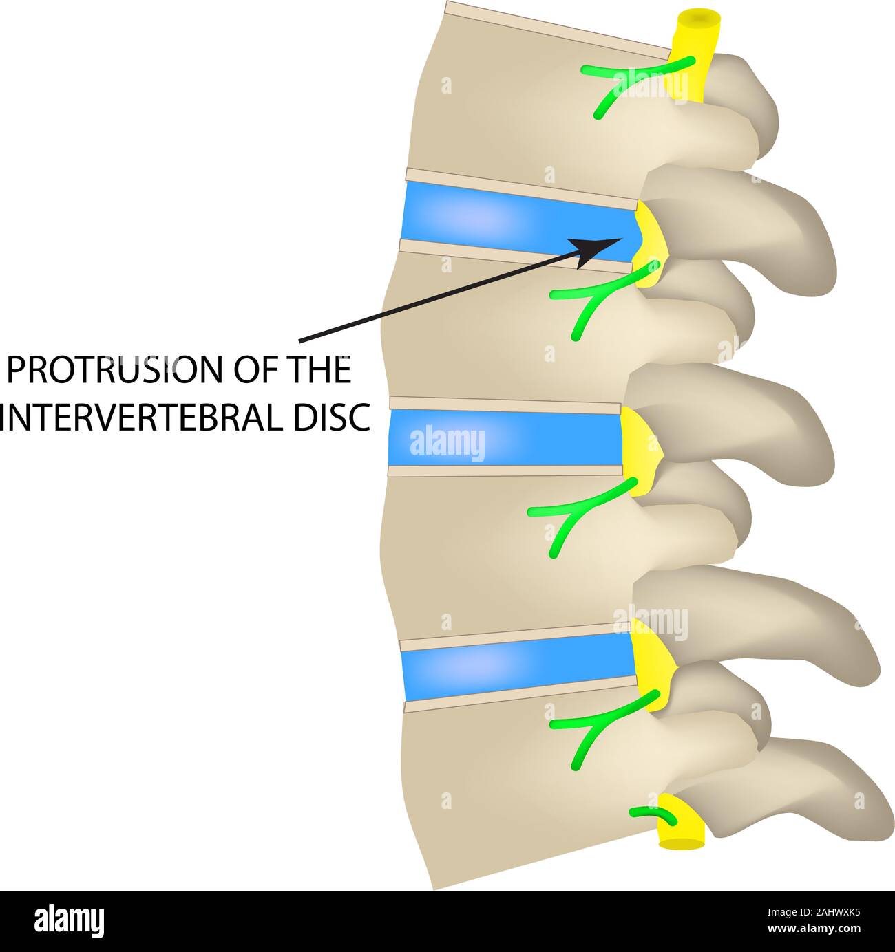 Intervertebral foramen hi-res stock photography and images - Alamy