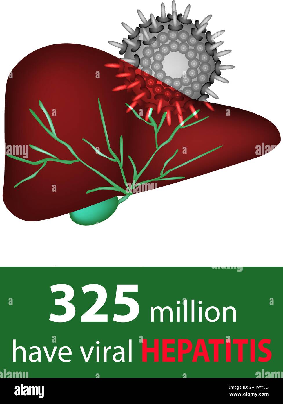 325 million have viral hepatitis. Liver and hepatitis virus. World Hepatitis Day. Infographics ...