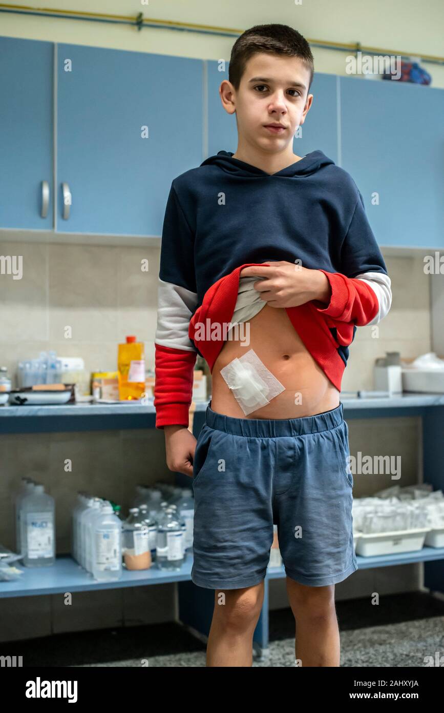 Appendicitis scar hi-res stock photography and images - Alamy