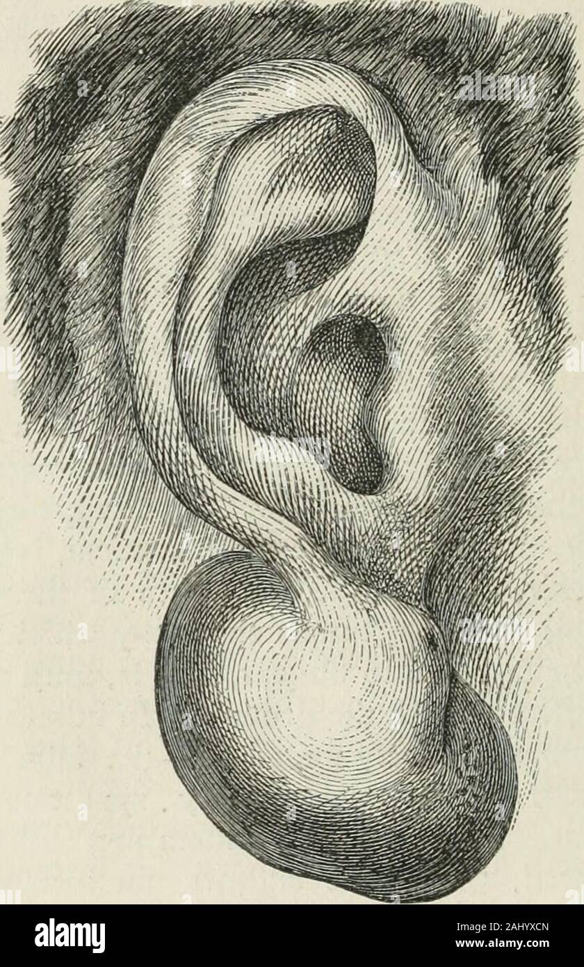 Archives of ophthalmology and otology . Turnbull, are not inclined to ...