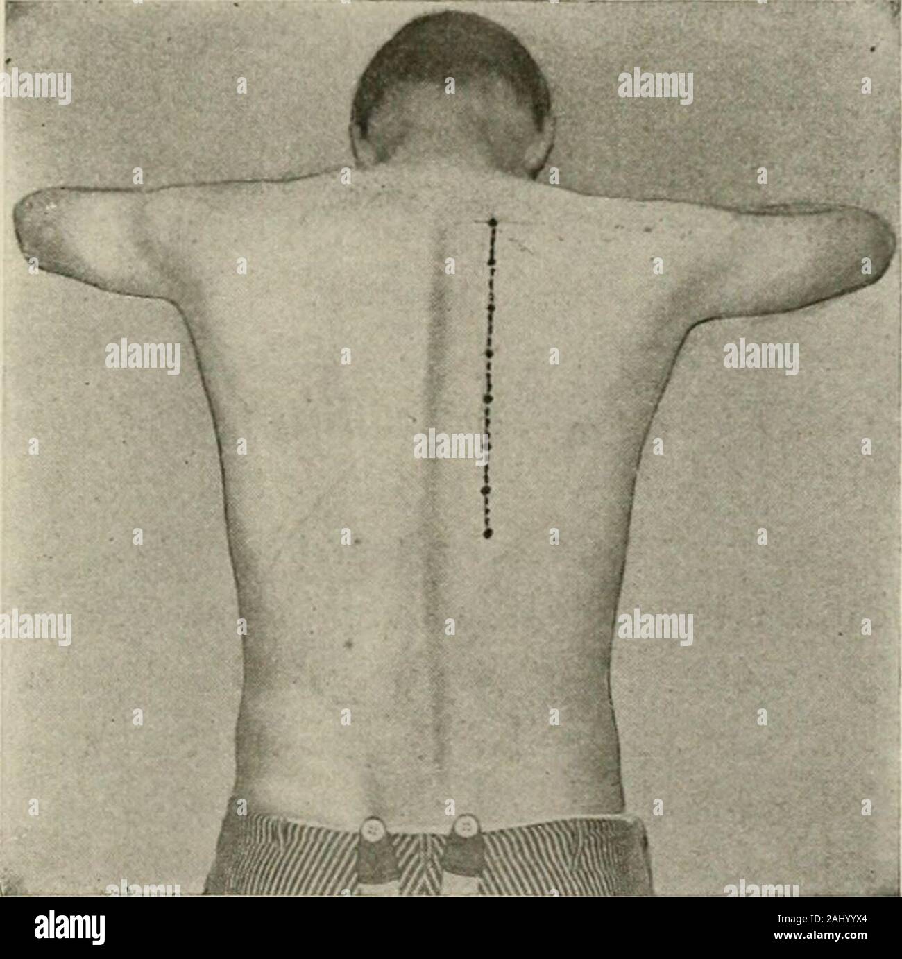 Local and regional anesthesia; with chapters on spinal, epidural ...