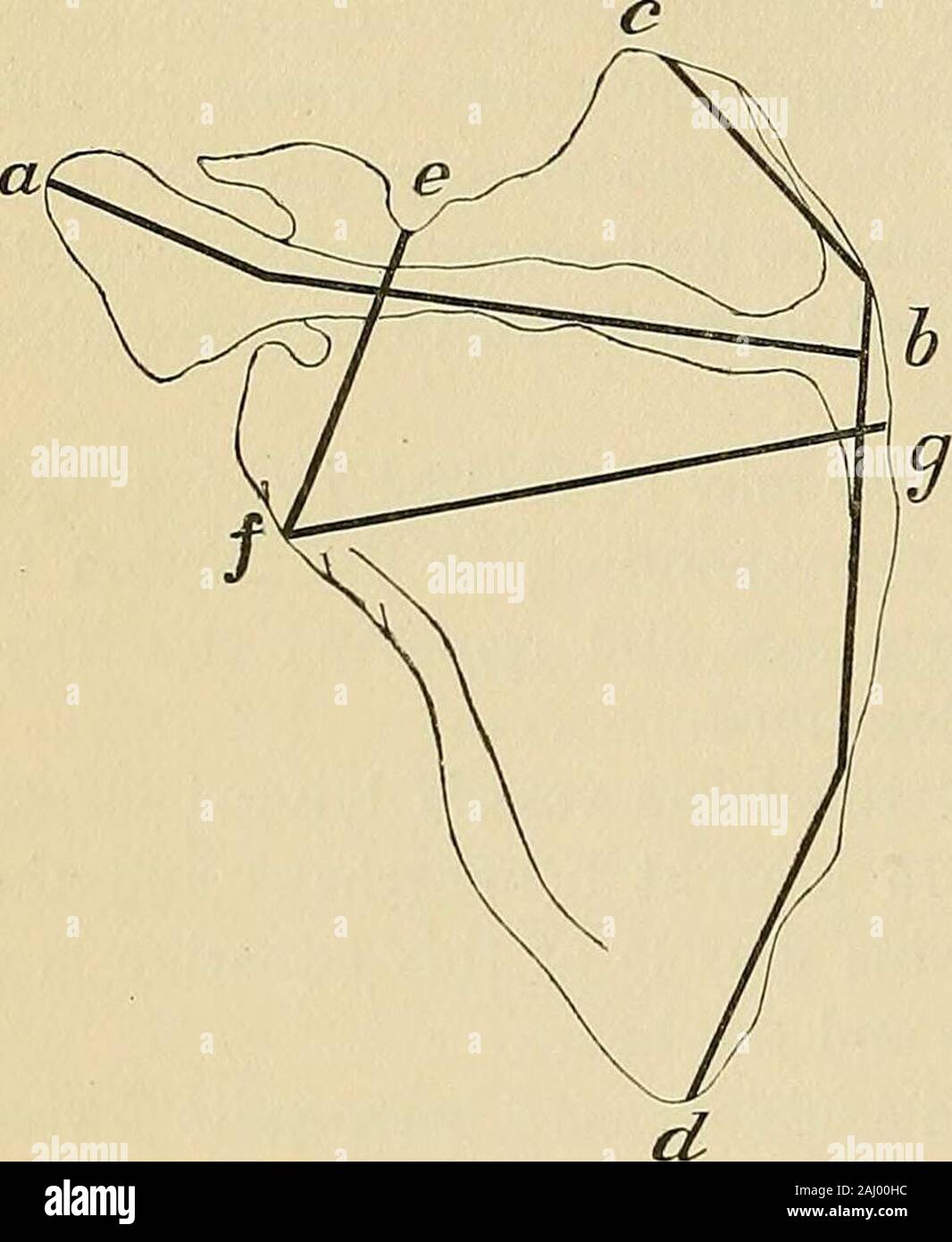 Inferior angle of scapula hi-res stock photography and images - Alamy