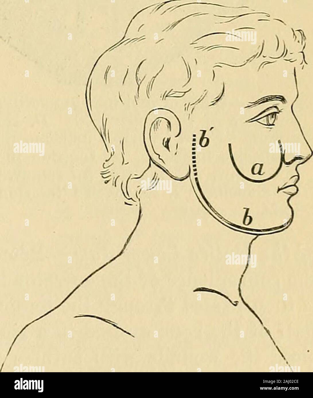 Operative surgery . n of thegenio-hyo-glossus muscle,- and if ...