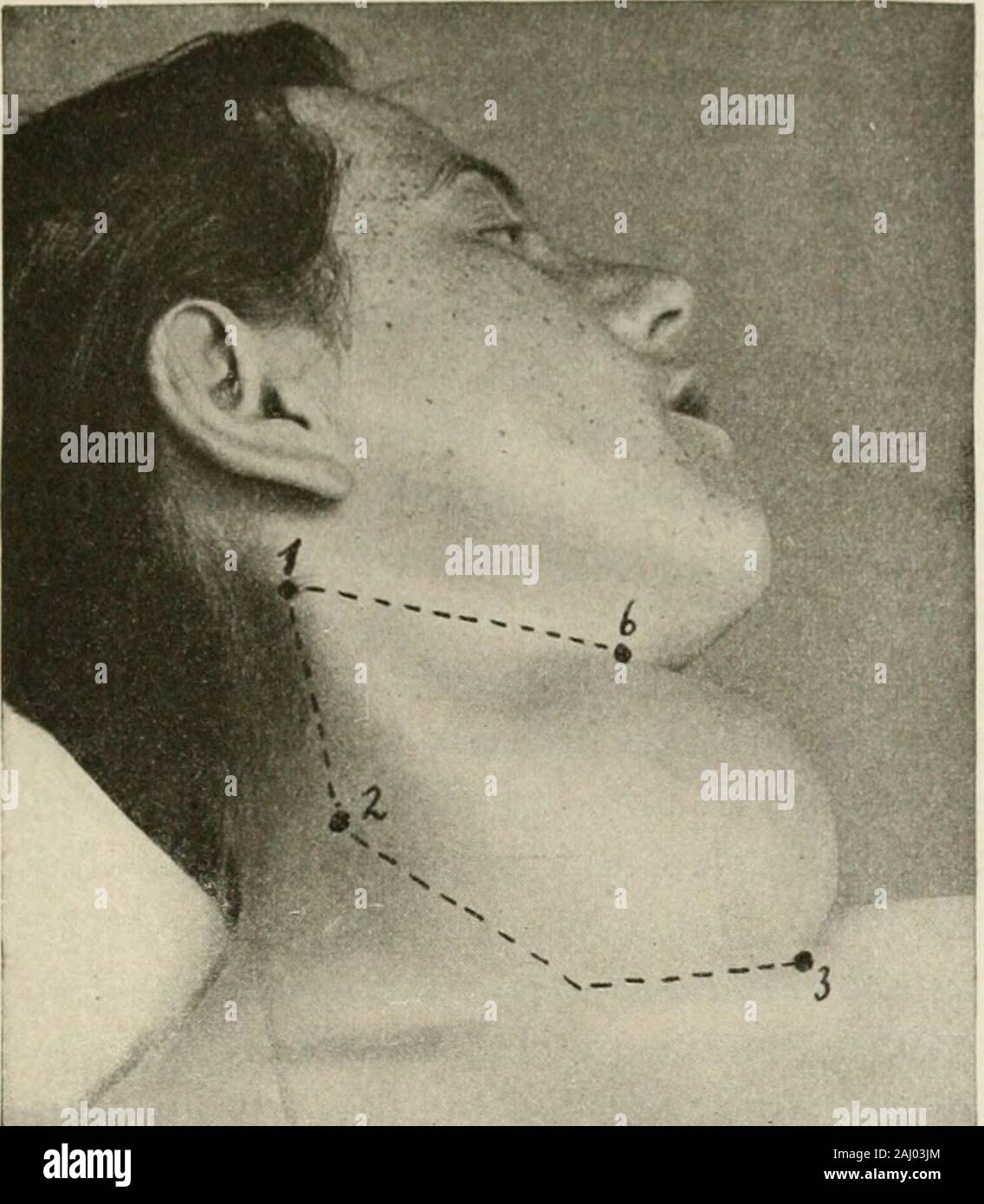 Local and regional anesthesia; with chapters on spinal, epidural ...