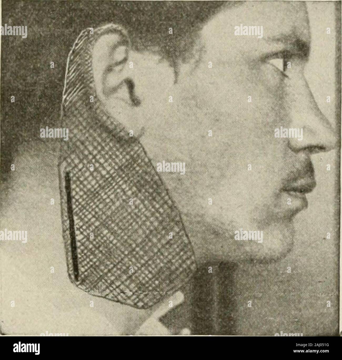 Epidural injections hi-res stock photography and images - Alamy