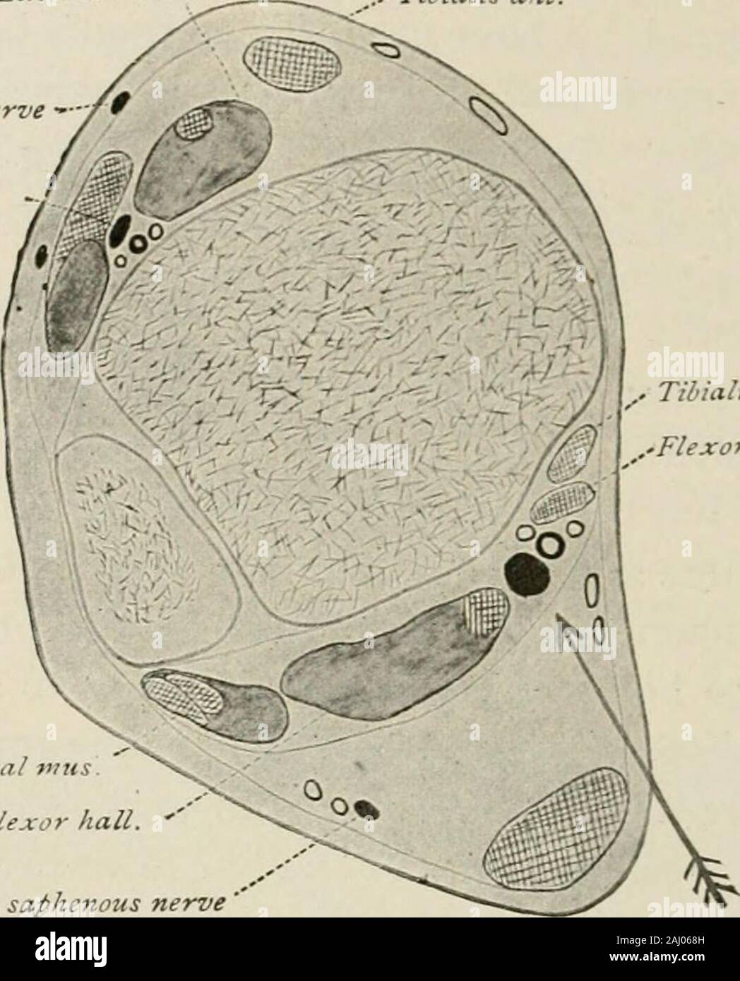 Local and regional anesthesia; with chapters on spinal, epidural ...