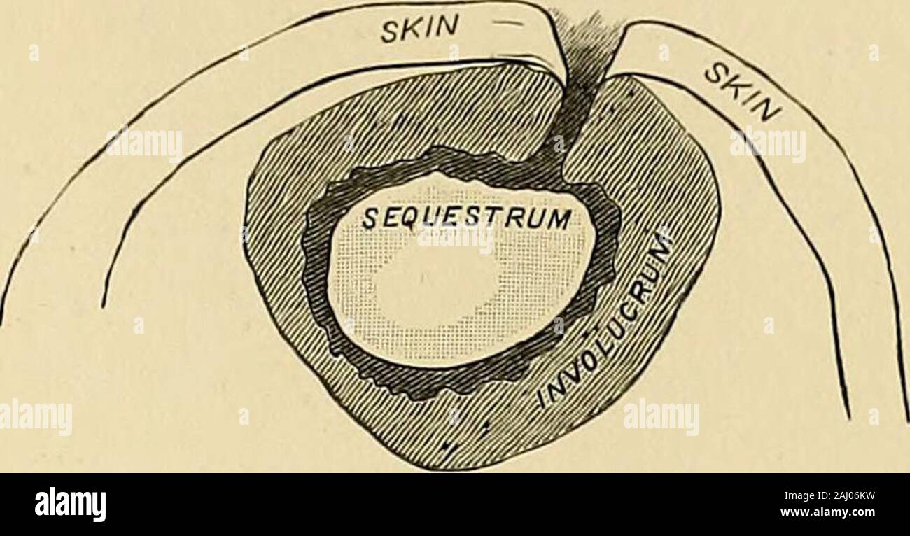 Cours masse hi-res stock photography and images - Alamy