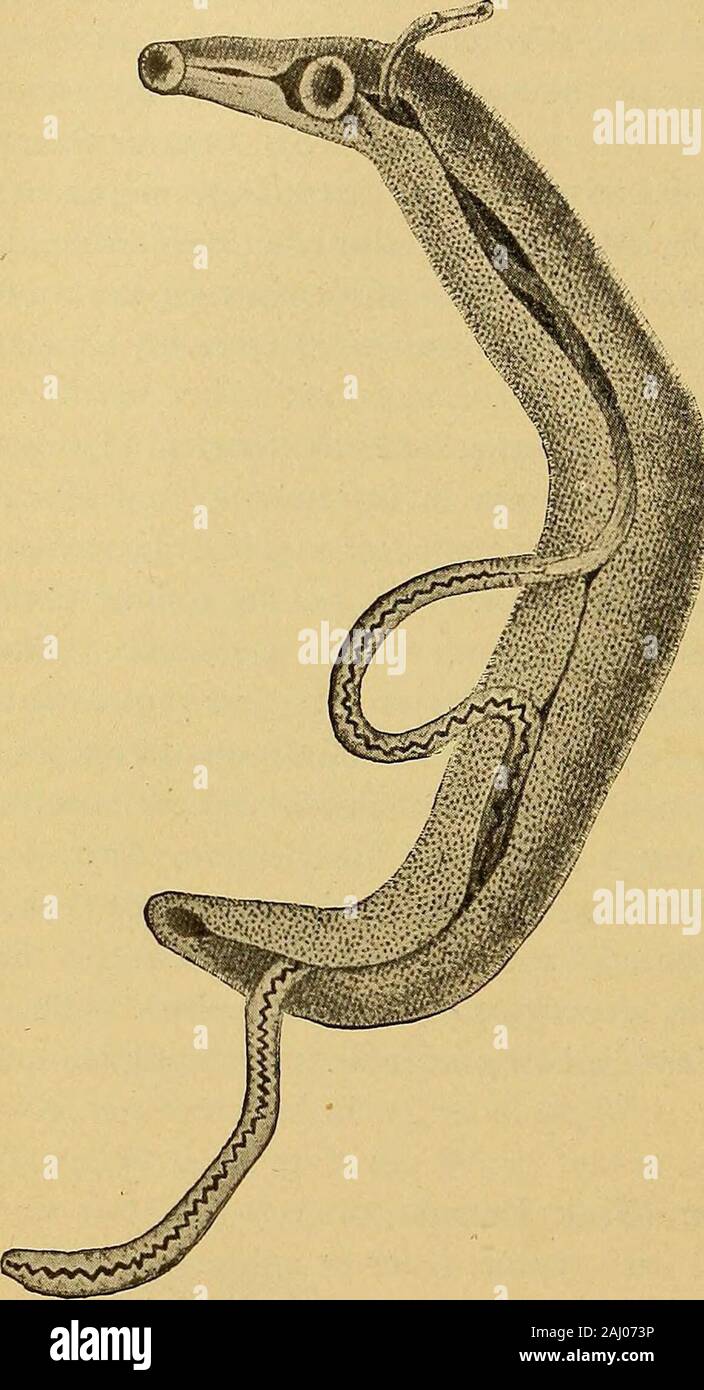 Bilharzia hi-res stock photography and images - Alamy