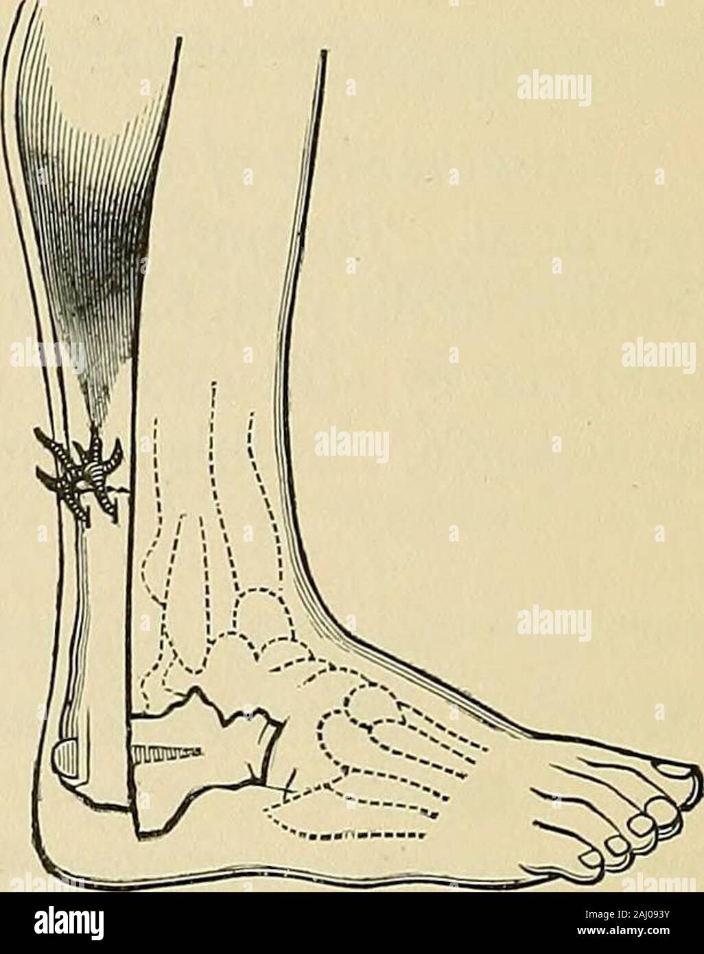 Os calcis hi-res stock photography and images - Alamy