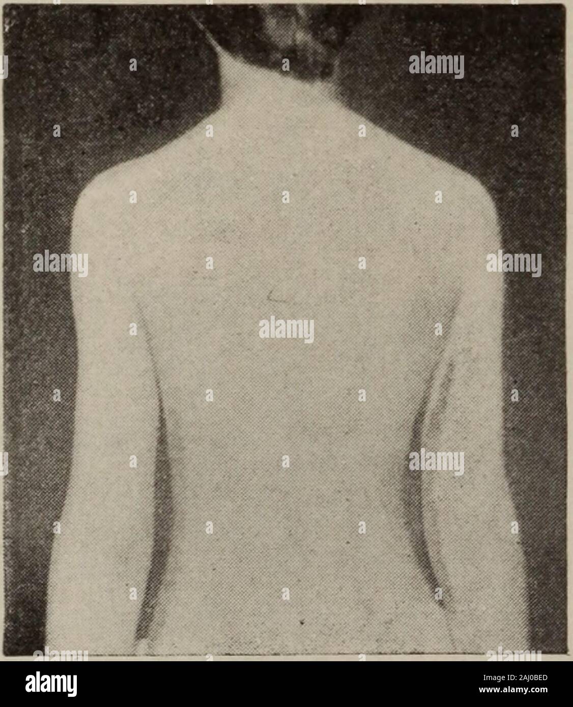 Arm on back of swing hi-res stock photography and images - Alamy