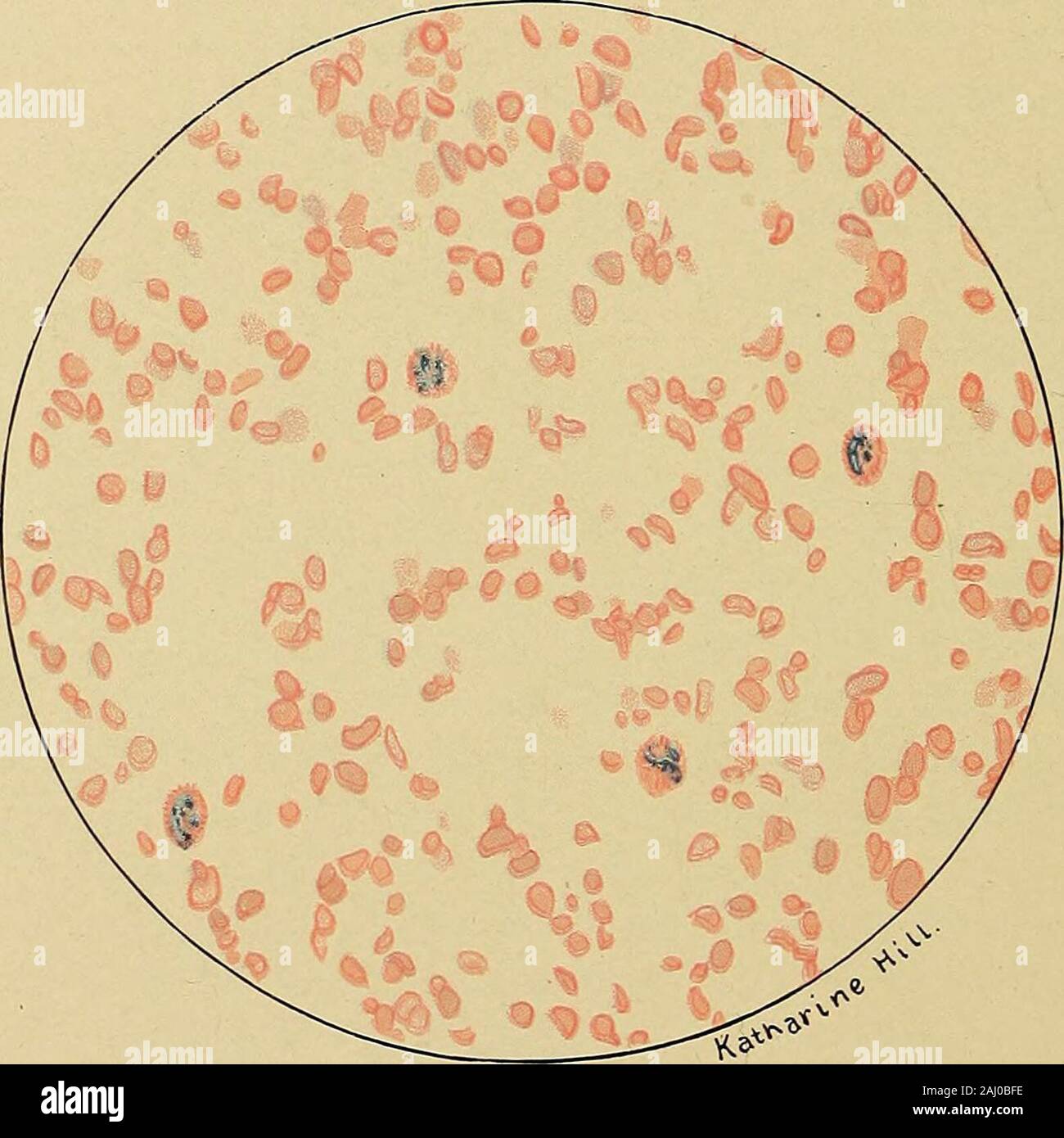 Poikilocytes hi-res stock photography and images - Alamy