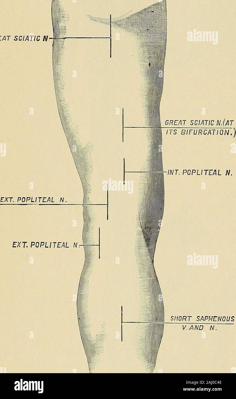 Internal popliteal hi-res stock photography and images - Alamy