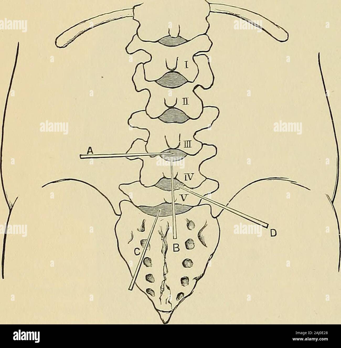 Operative surgery . he Operation.—Ad-minister an anesthetic;place the ...