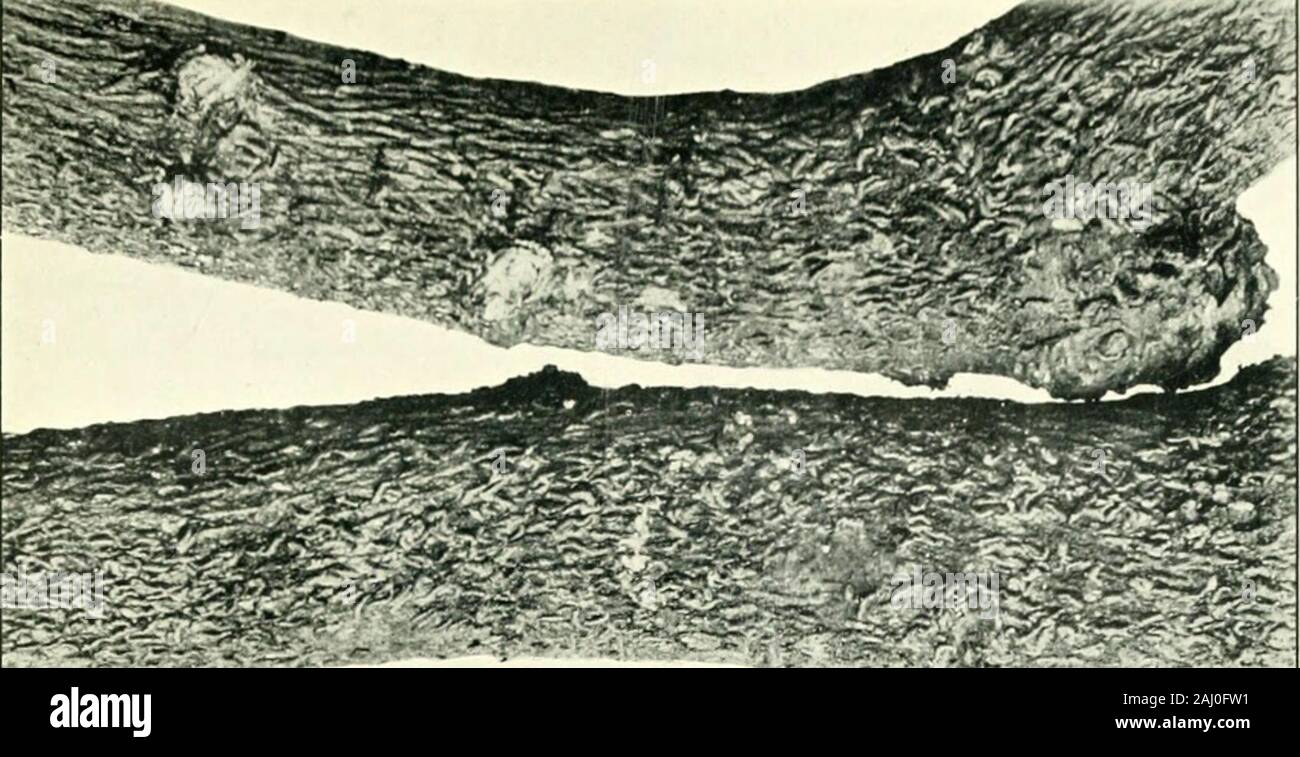 Cryptococcus hi-res stock photography and images - Alamy