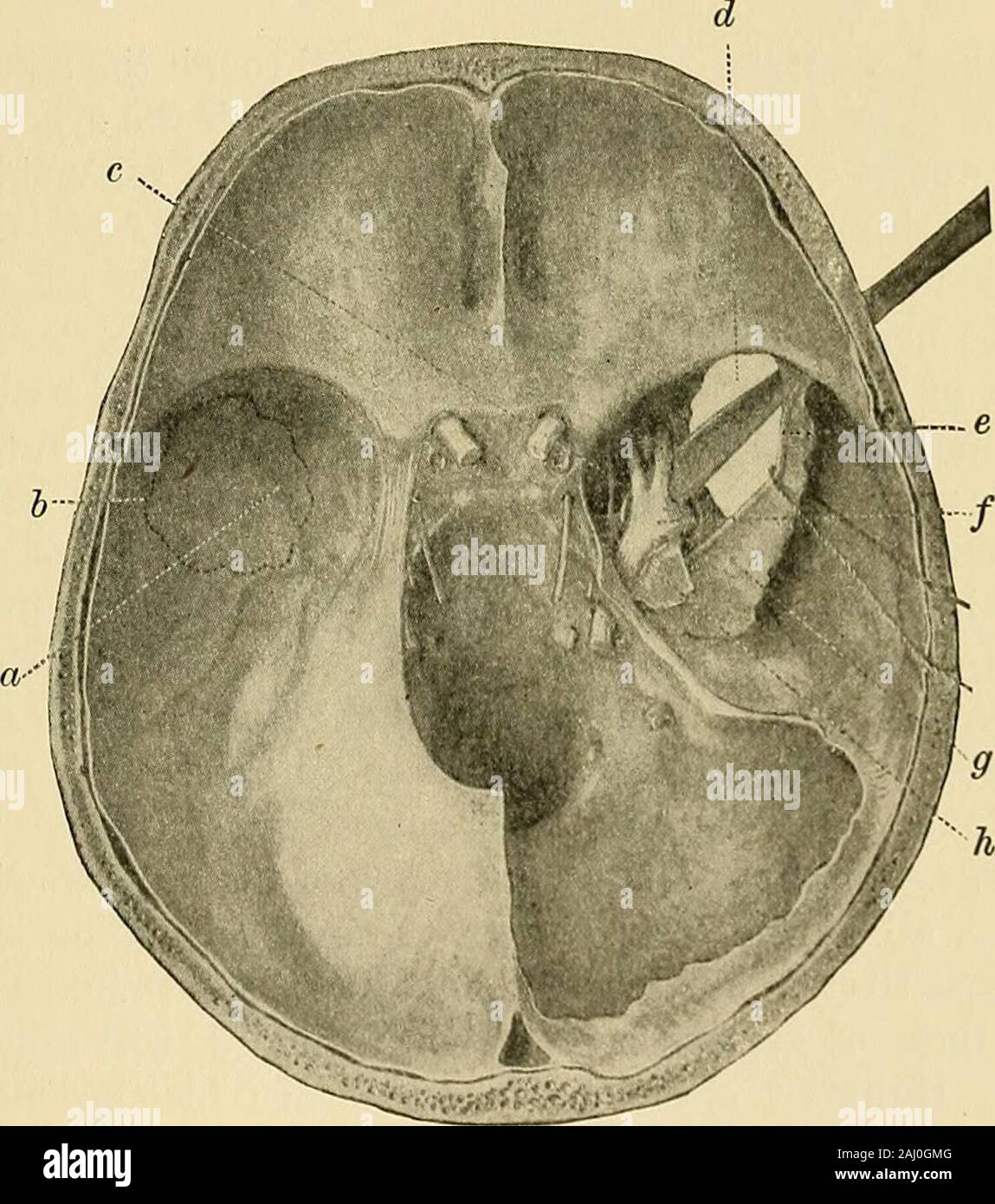 Frontalis muscle hi-res stock photography and images - Alamy