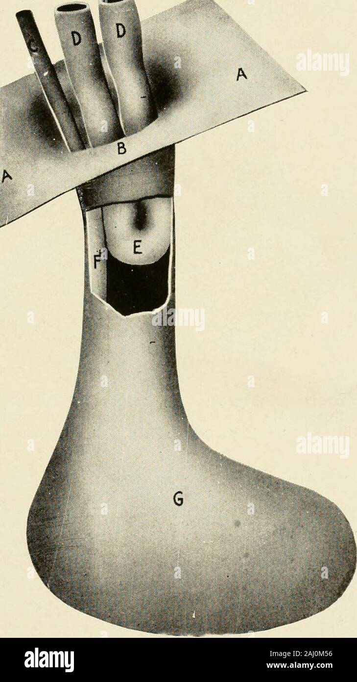 Epididymus hi-res stock photography and images - Alamy